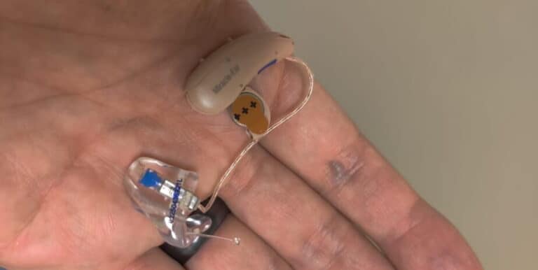 Making the Right Choice: Hearing Aid Domes or Earmolds – Pros and Cons ...